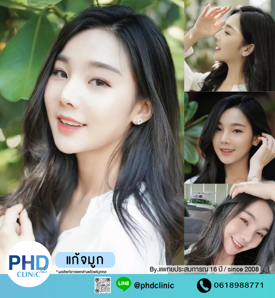 เสริมจมูกกรุงเทพ Phd Clinic - phd-Clinic