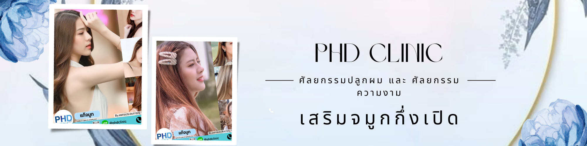 เสริมจมูกแบบกึ่งเปิด (SEMI OPEN TECHNIQUE)