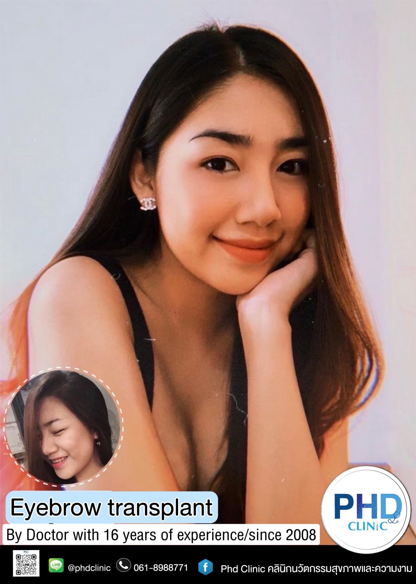 Eyebrow transplant pattaya - phd-Clinic