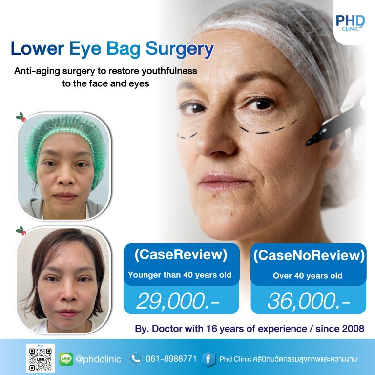 Lower Eye Bag Surgery Pattaya - phd-Clinic