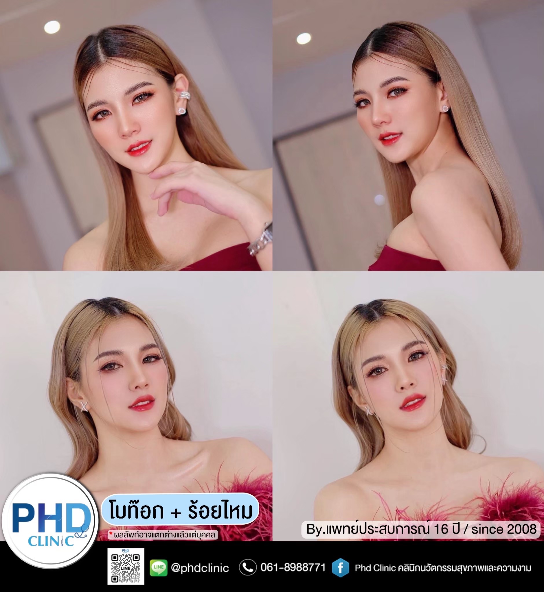 โบท็อกพัทยาที่ไหนดี - phd-Clinic